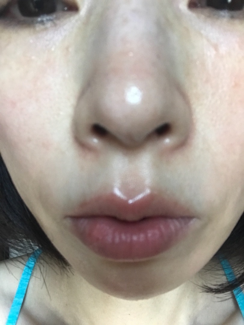 ルビーセル2日目: ルビーセル